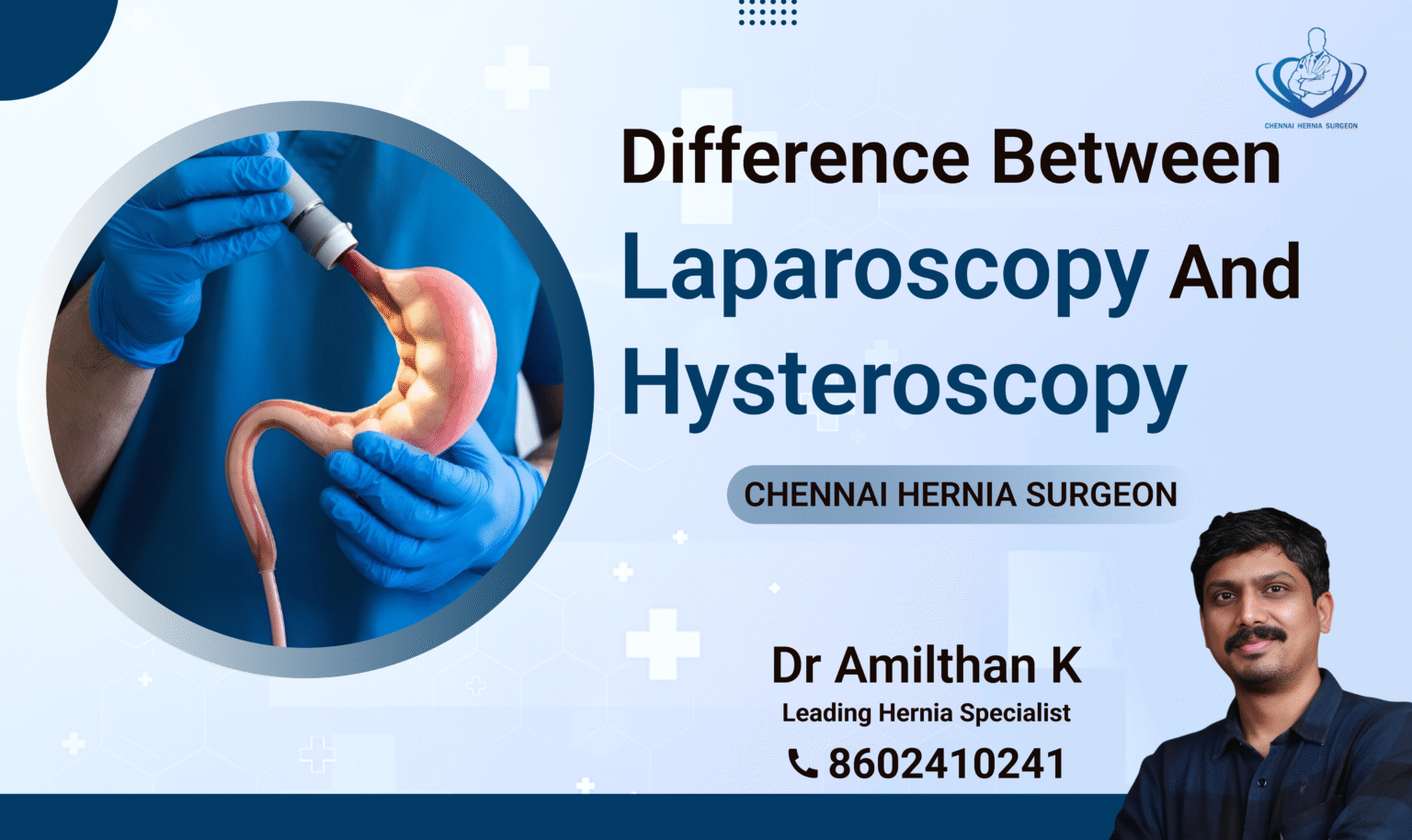 Difference Between Laparoscopy and Hysteroscopy - chennaiherniasurgeon