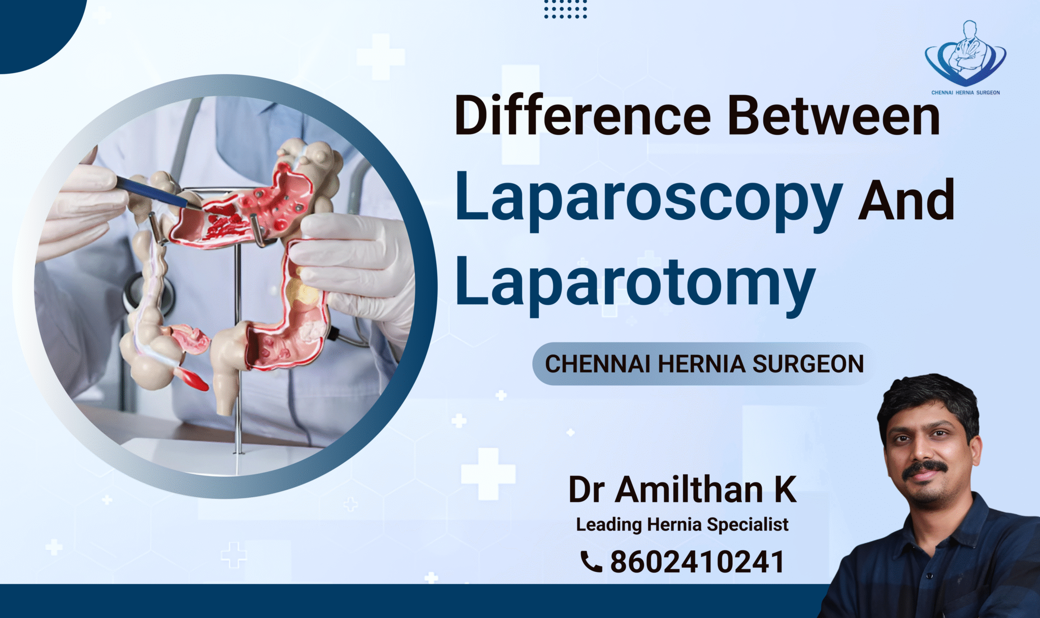 Difference between Laparoscopy and Laparotomy - chennaiherniasurgeon