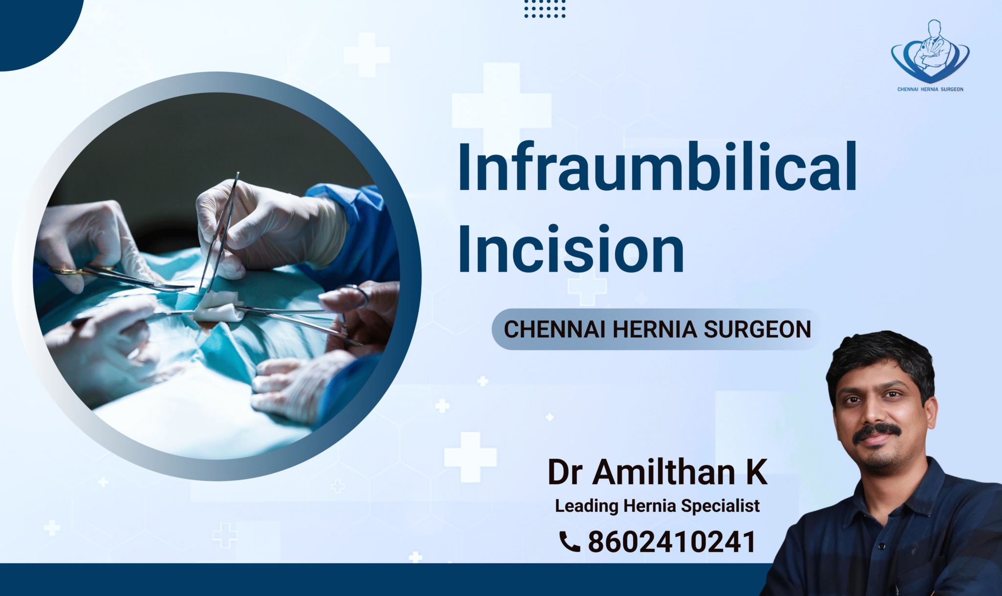 Infraumbilical Incision - chennaiherniasurgeon