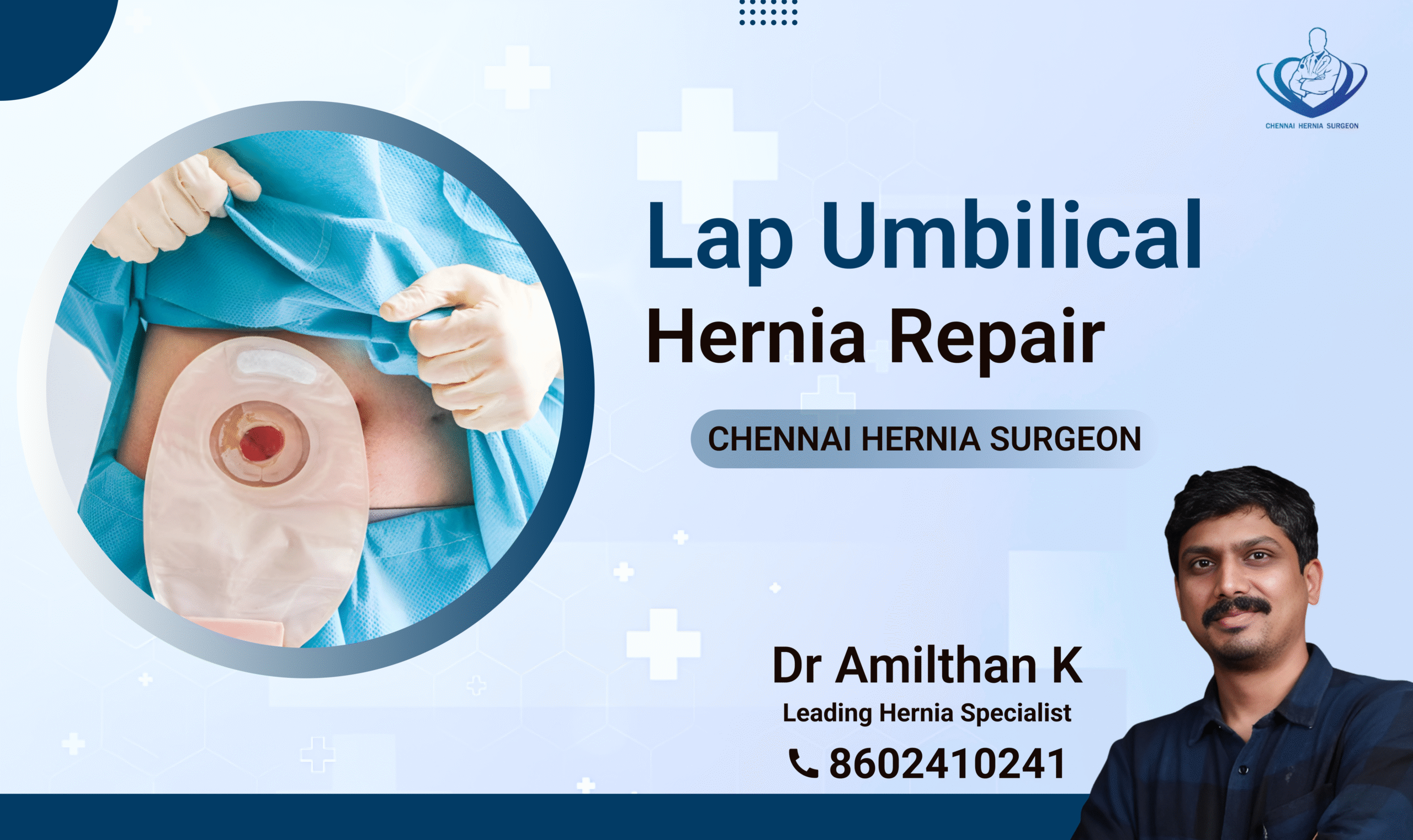 Lap Umbilical Hernia Repair - chennaiherniasurgeon