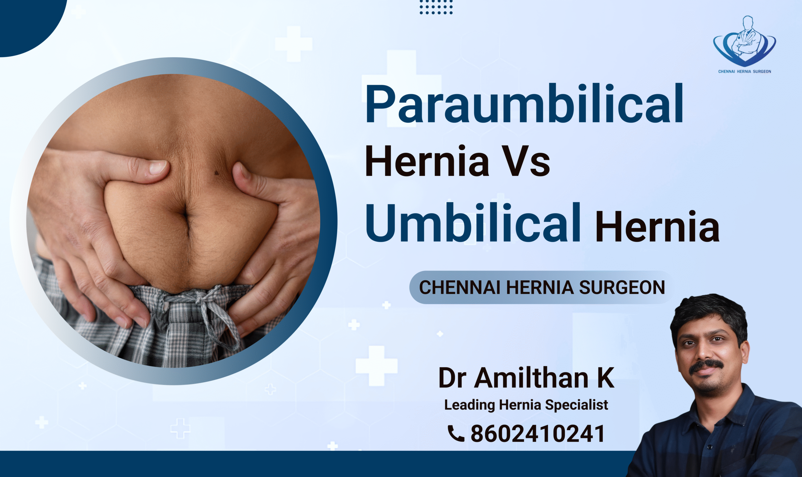 Paraumbilical Hernia vs Umbilical Hernia - chennaiherniasurgeon